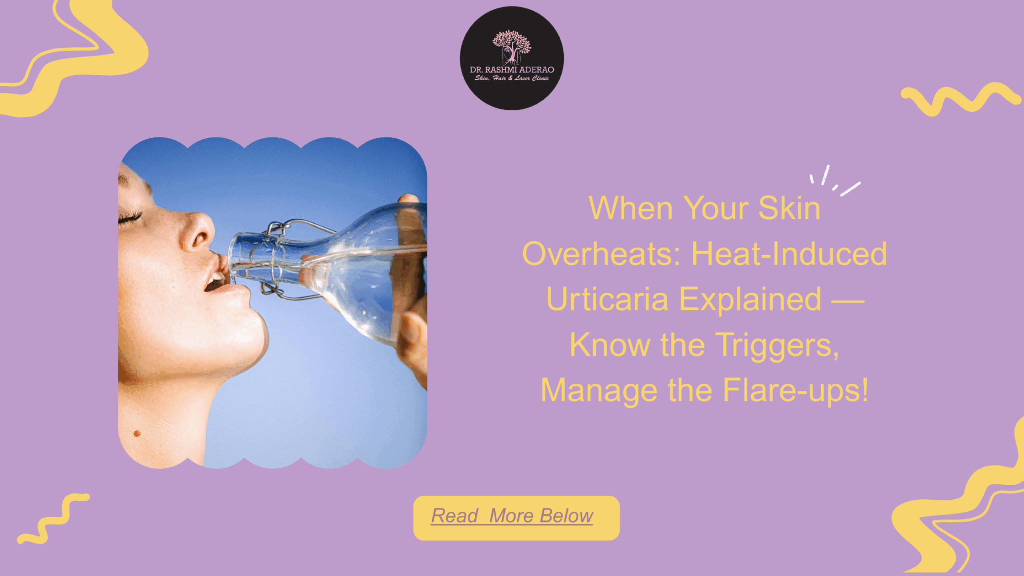 Heat-Induced Urticaria: What It Is, Why It Happens & How to Manage It ...